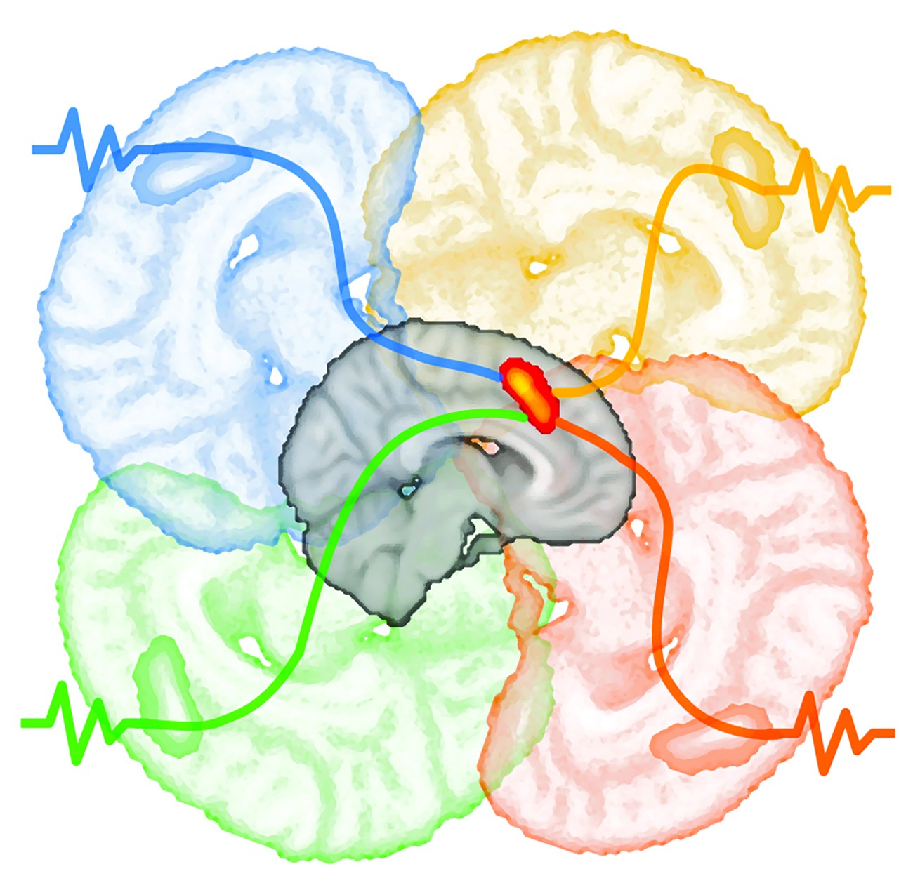 Neurosciences cognitives | Institut du Cerveau